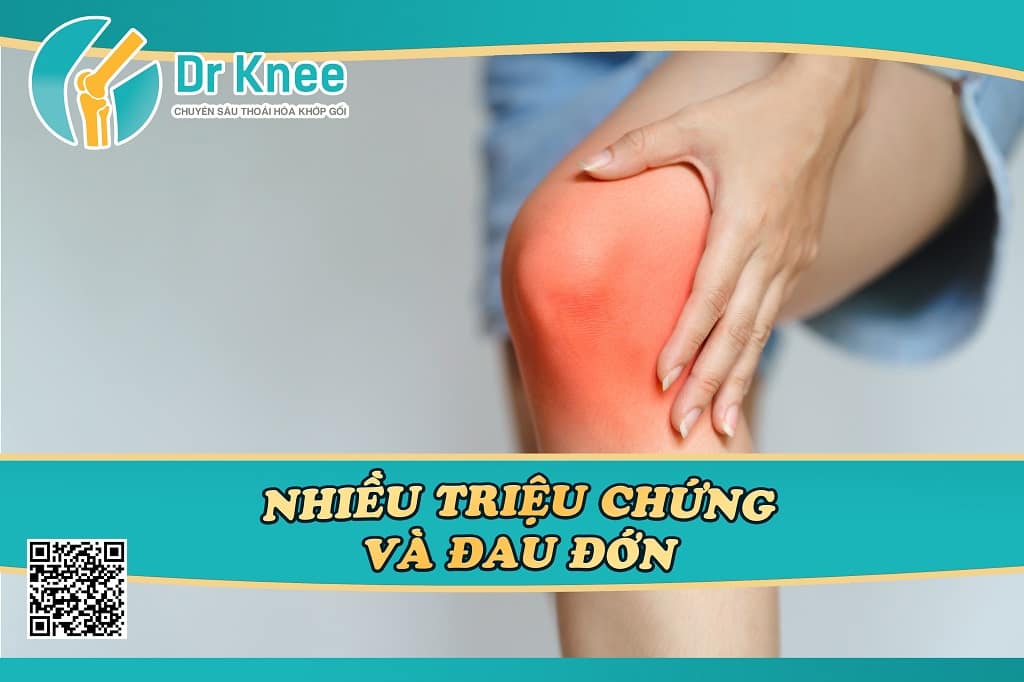 Kích Thích Tủy Xương Trong Điều Trị Thoái Hóa Khớp Gối |2023